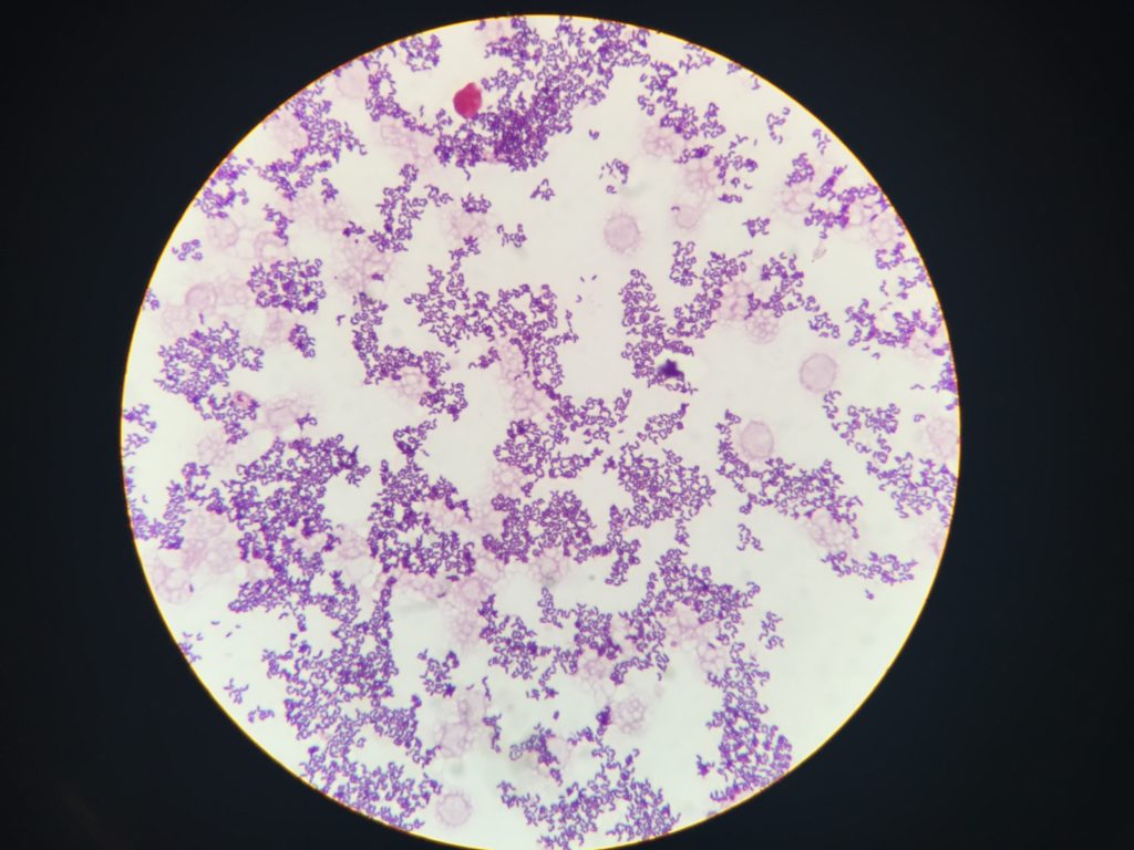 Stomacher prepares samples of mouse spleen and liver for Listeria